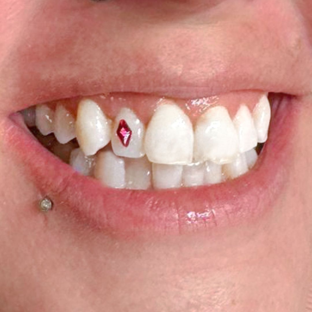 Tooth Gem Online Course